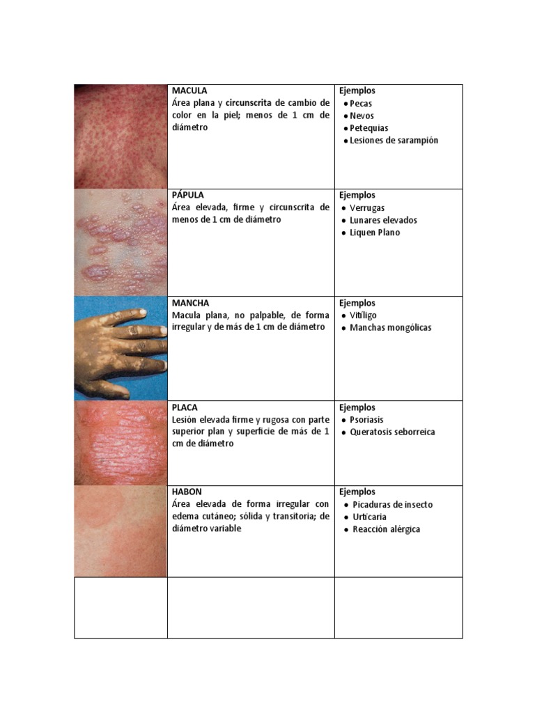 Tipos de Lesiones Dermatologicas 2020 | PDF | Piel | Epidermis