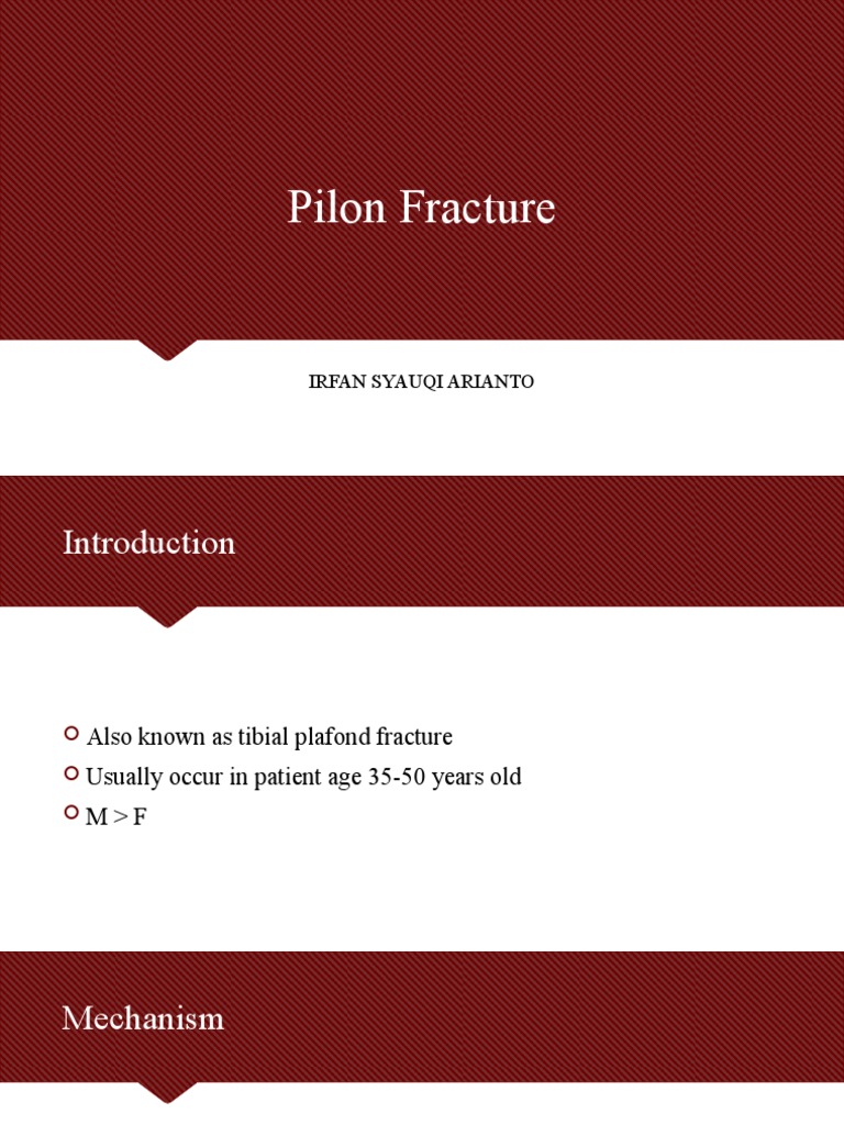 Pilon Fracture: Irfan Syauqi Arianto | PDF