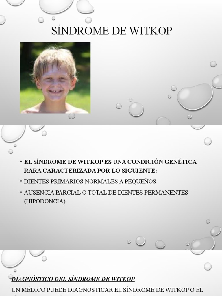 Síndrome de Witkop | PDF
