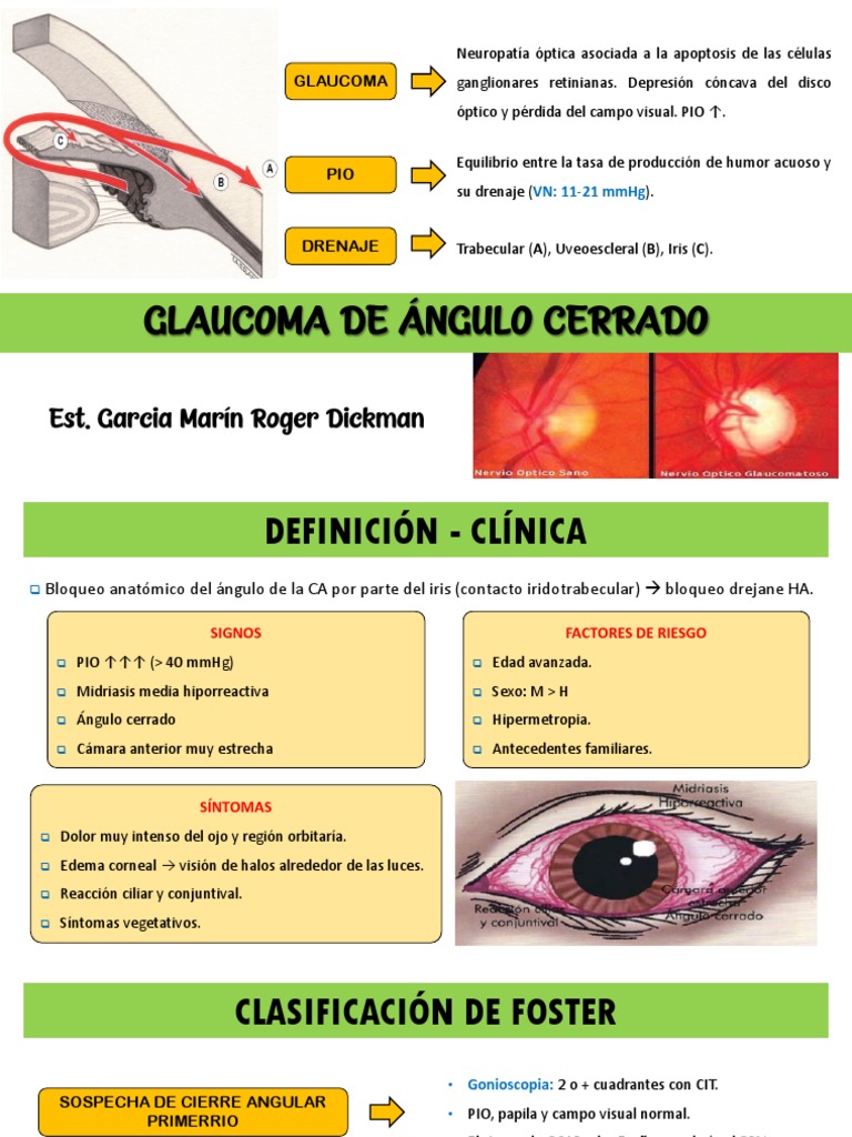Glaucoma de Ángulo Cerrado | PDF | Glaucoma | Oftalmología