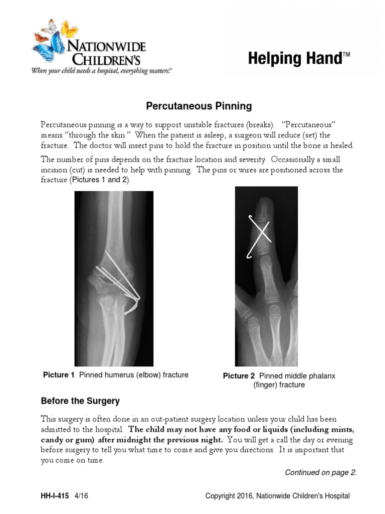 Percutaneous Pinning: Pictures 1 and 2 | PDF | Surgery | Patient