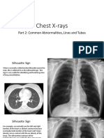Imaging Techniques for Lung Collapse | PDF | Lung | Medical Specialties