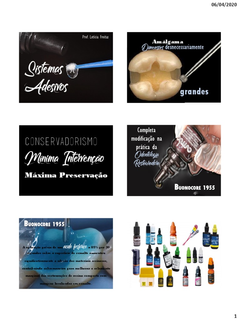 Sistemas Adesivos em PDF | PDF | Dentina | Esmalte dentário