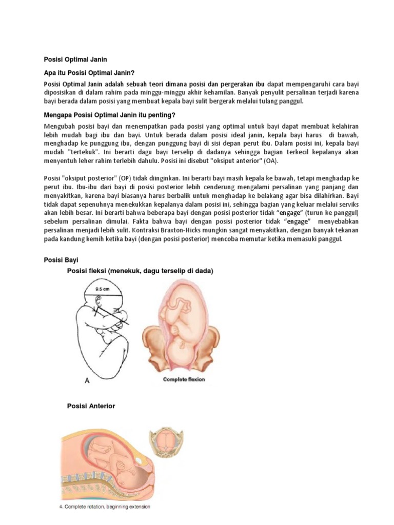 Optimalisasi Posisi Janin | PDF
