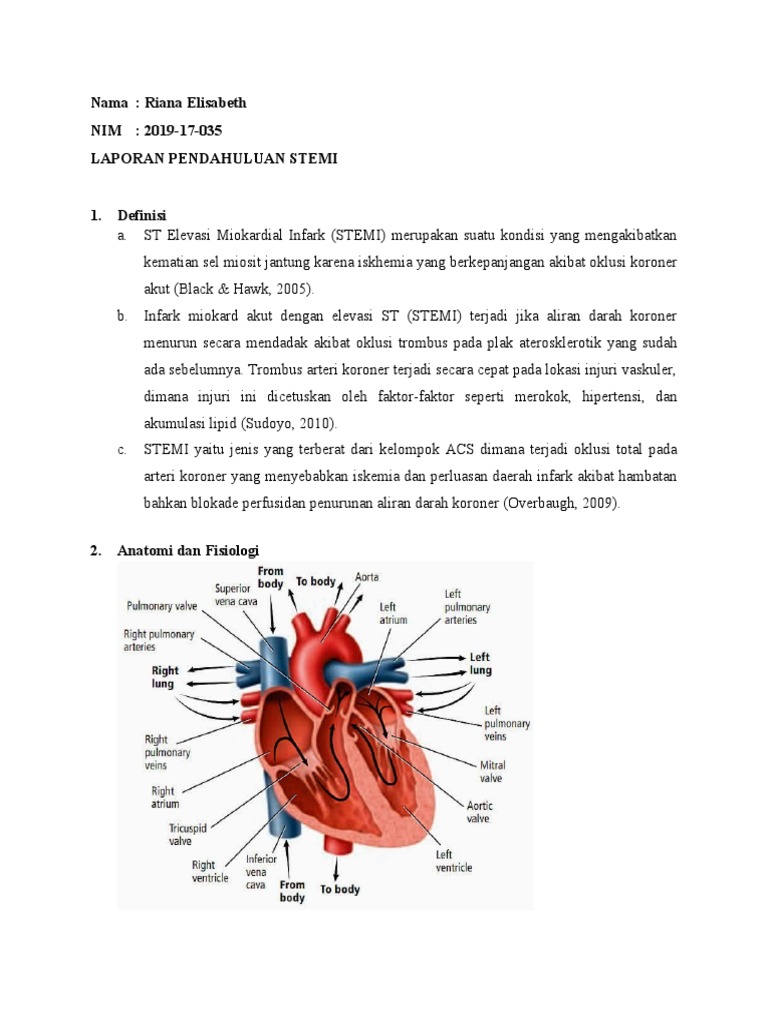 LP STEMI - Riana Elisabeth | PDF