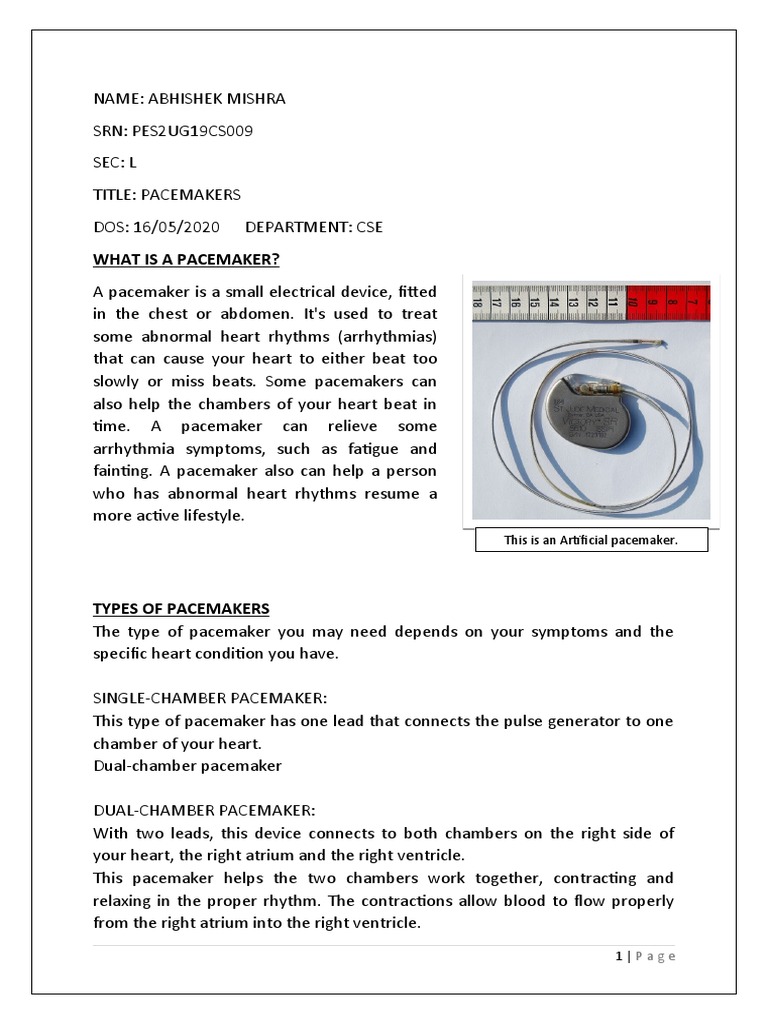 What Is A Pacemaker? | PDF | Artificial Cardiac Pacemaker | Heart