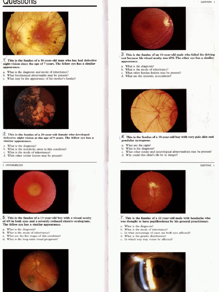 Kanski Picture Test | PDF