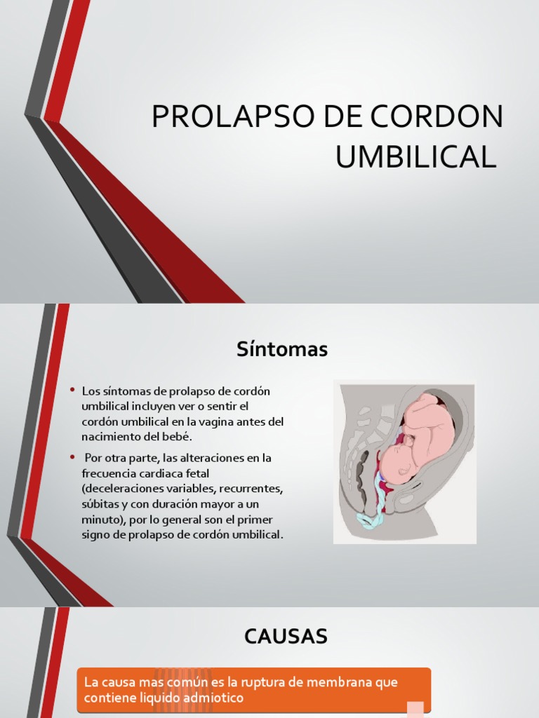 Prolapso de Cordón Umbilical: Síntomas y Causas | PDF