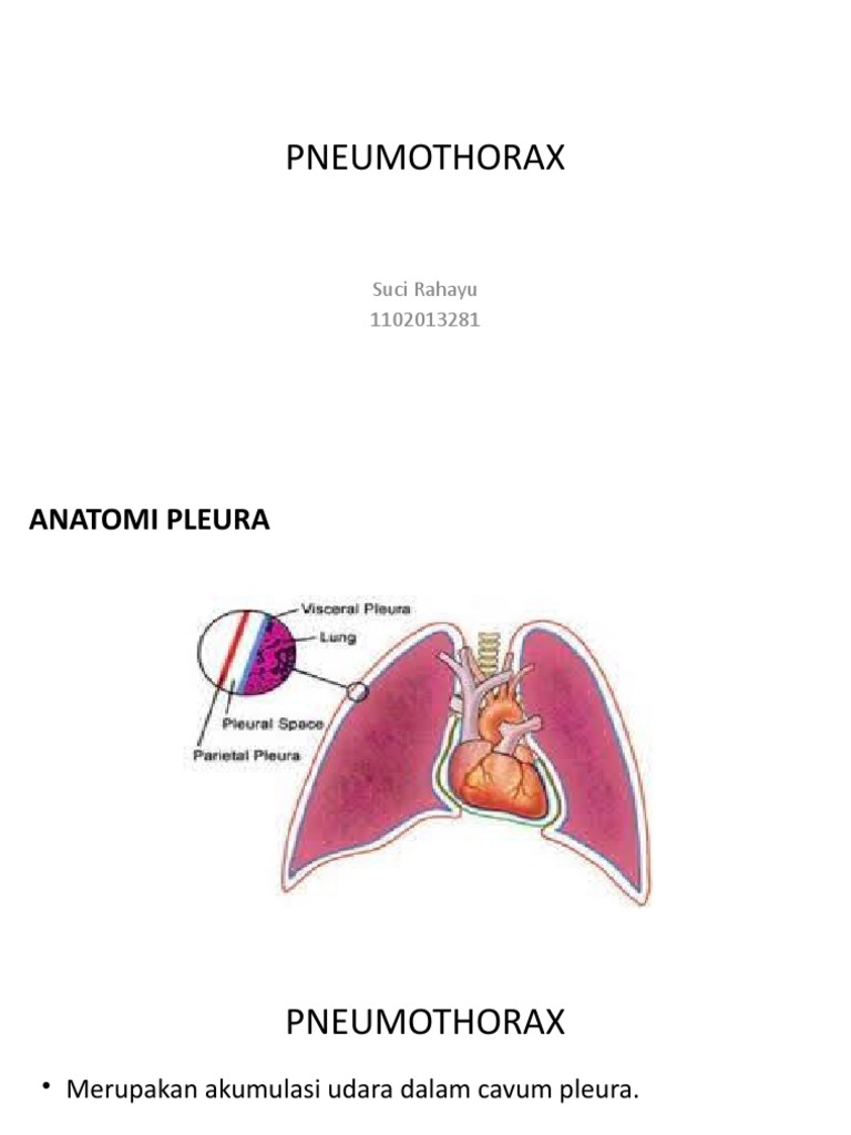 PNEUMOTORAKS Radiologi | PDF