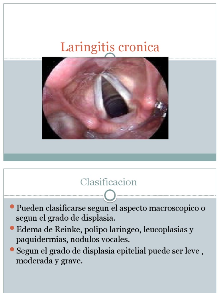 Laringitis Cronica-1 | PDF | Enfermedades y trastornos humanos | Rtt