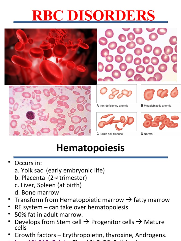 RBC Disorders | PDF | Anemia | Red Blood Cell