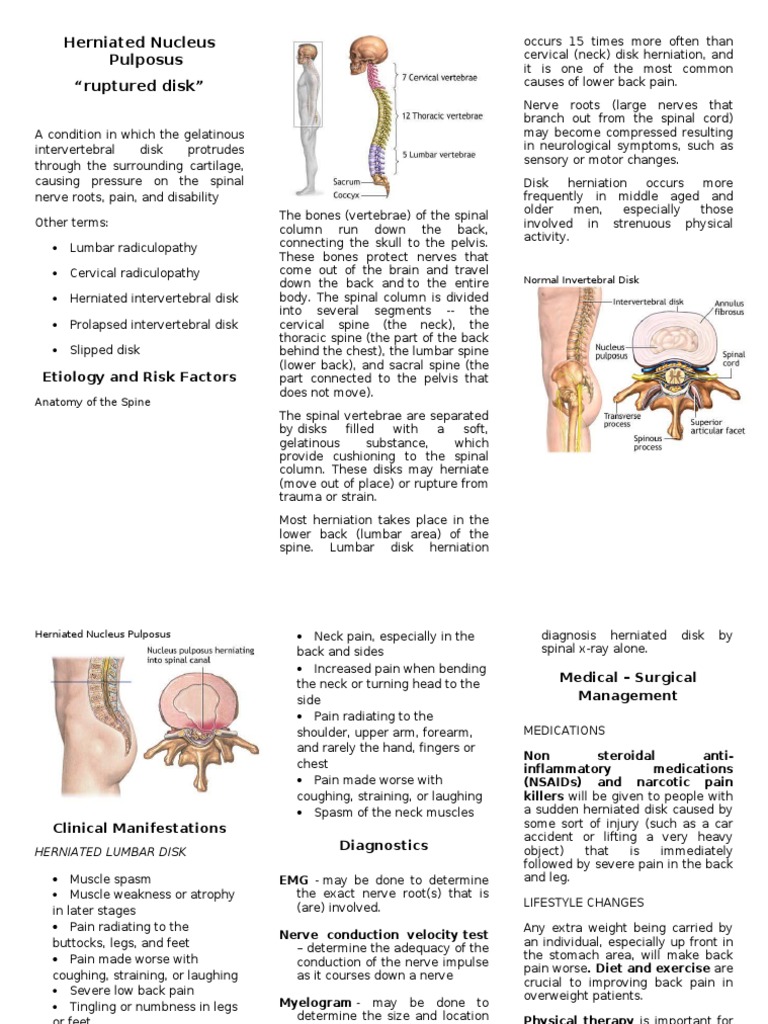 Herniated Nucleus Pulposus | Vertebral Column | Back Pain