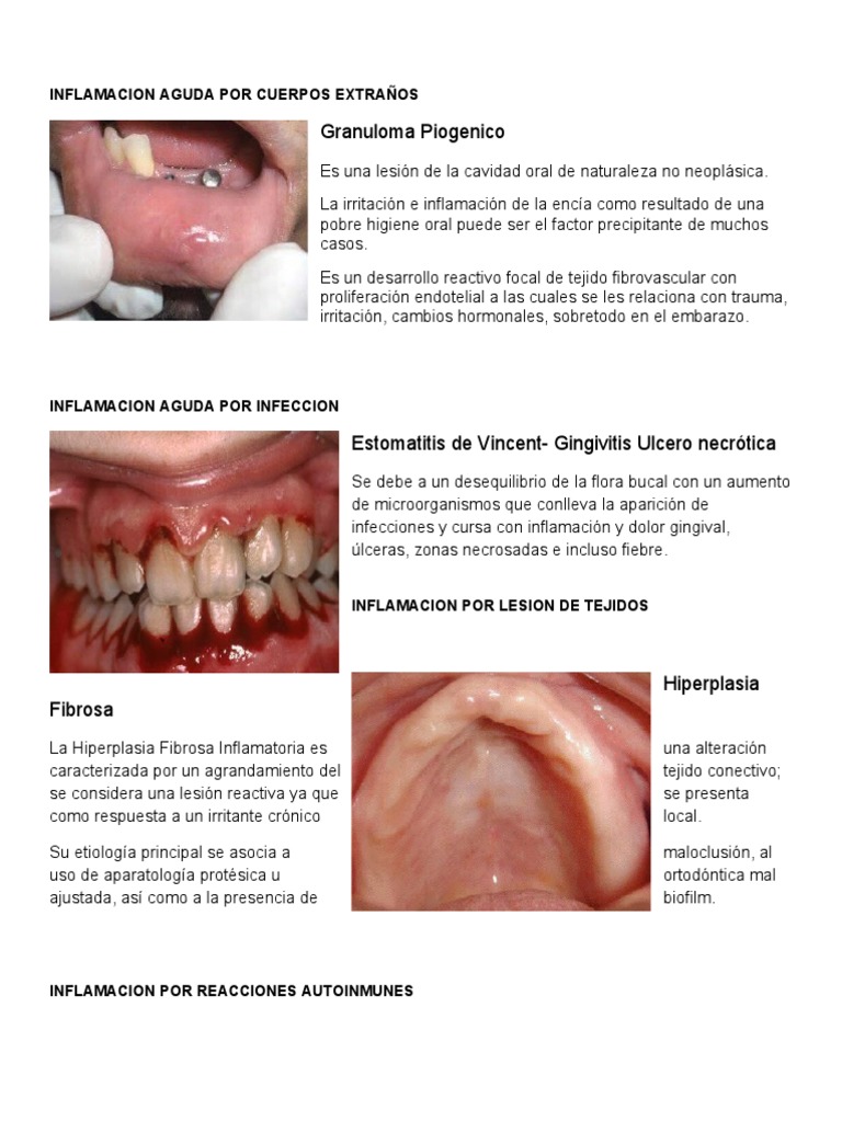 Inflamación oral causas | PDF