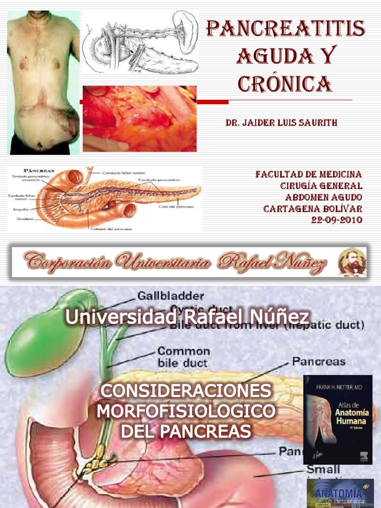 Pancreatitis Aguda y Cronica | PDF | Páncreas | Gastroenterología