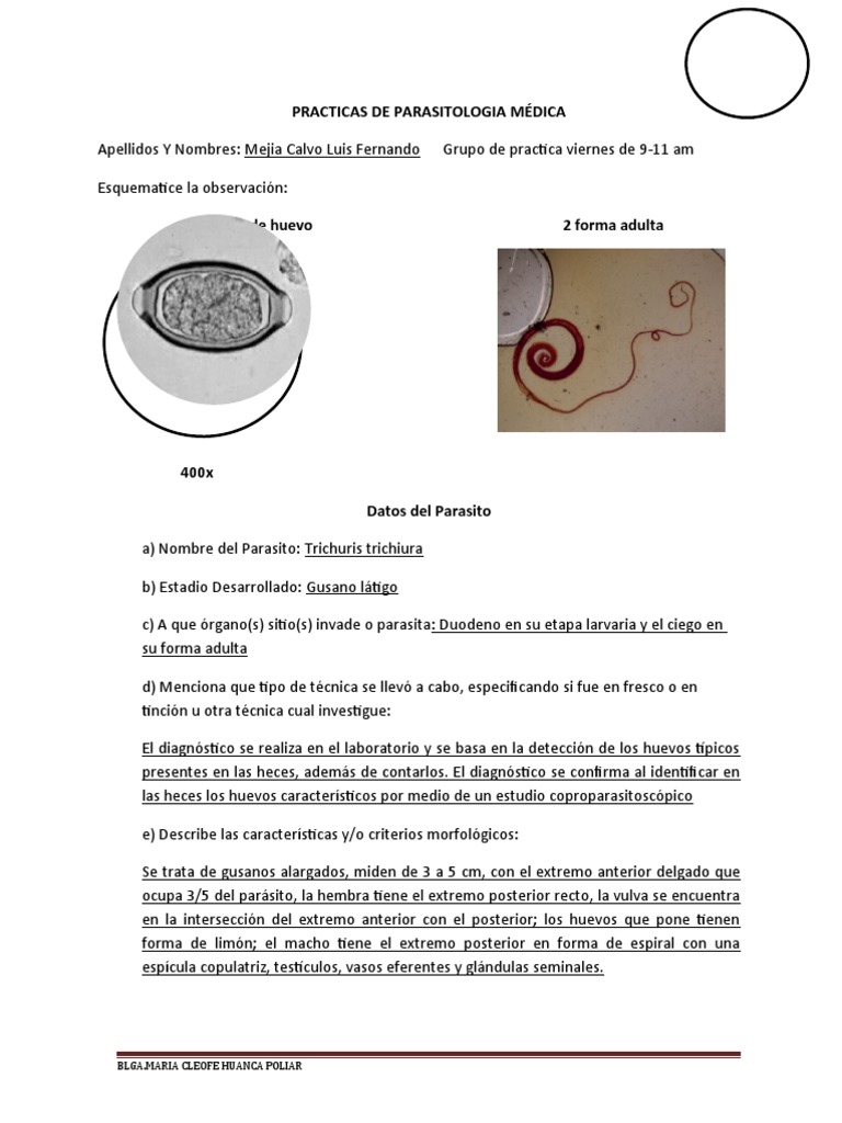 Trichuris Trichiura | PDF