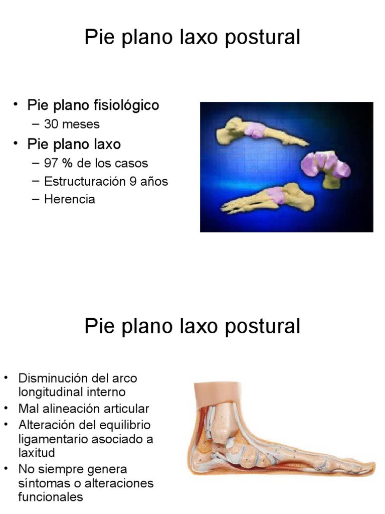 Pie Plano | PDF | Pie | Anatomía humana
