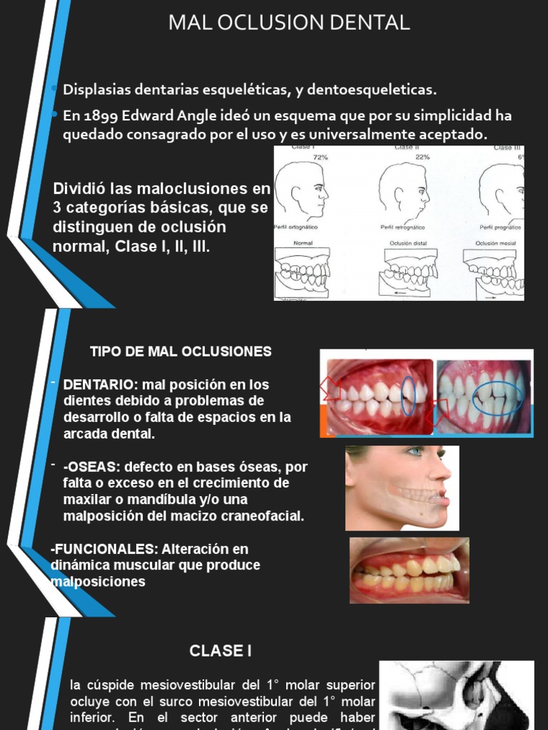 Manual de Mal Oclusiones - Subir | PDF | Ortodoncia | Odontología
