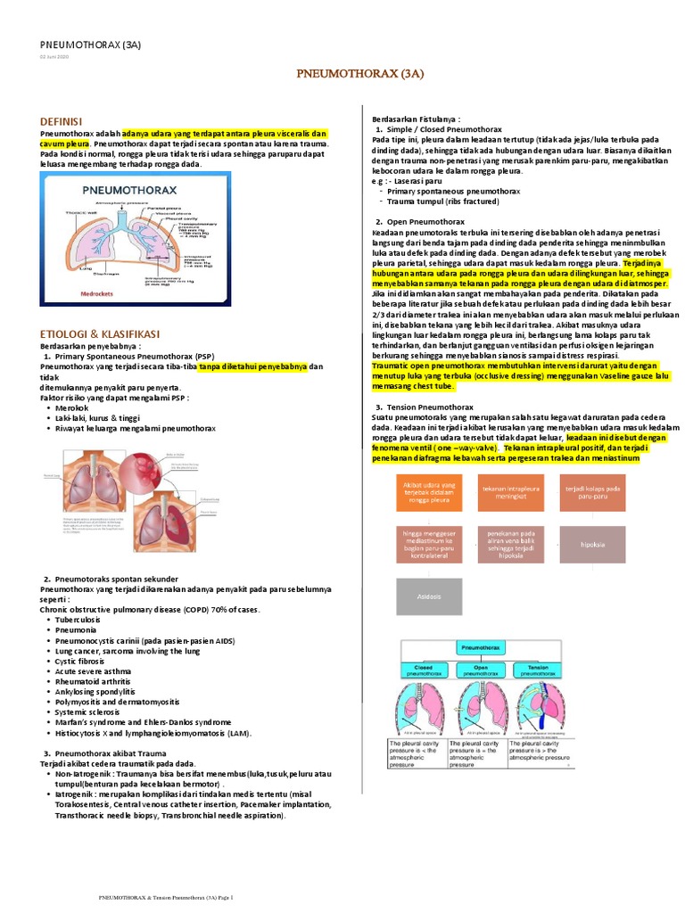 Pneumothorax &tension Pneumothorax (3a) | PDF