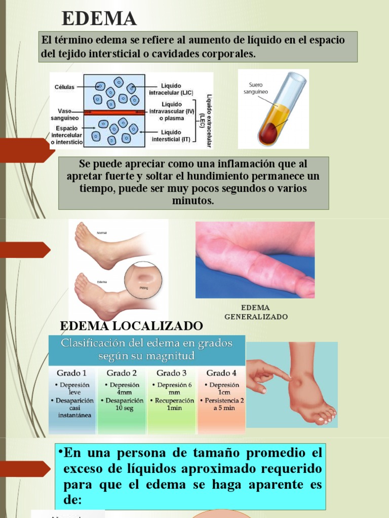 Edema 1 | PDF | Edema | Insuficiencia cardíaca