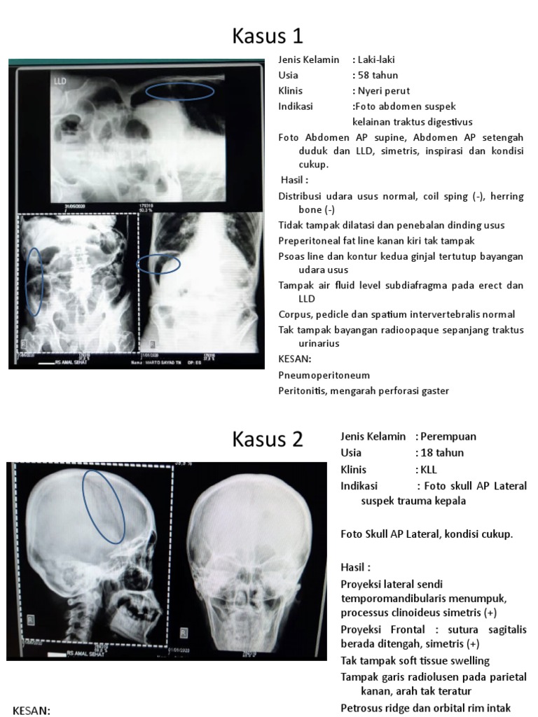 Penugasan Membaca Rontgen Agung Ilham S - 14711118 | PDF