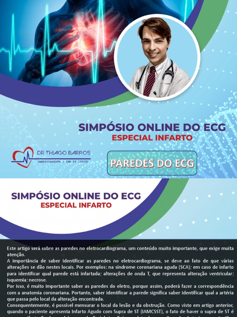 Apostila SOE - Paredes Do ECG | PDF | Infarto do Miocárdio ...