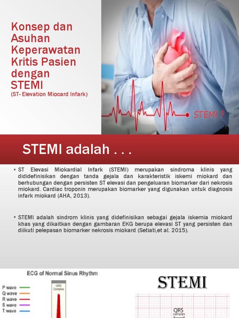 Stemi | PDF