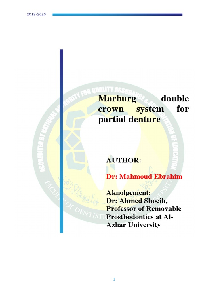 Marburg Double Crown System For Partial Denture | PDF | Dentures ...