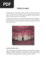 Defectos Óseos | PDF | Hueso | Especialidades Medicas