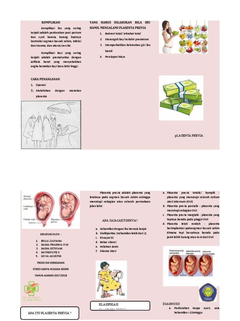 Leaflet VK Ird-1 | PDF