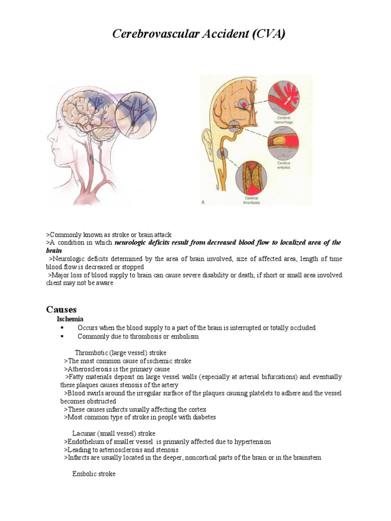 Case Study Cva | PDF | Stroke | Thrombosis