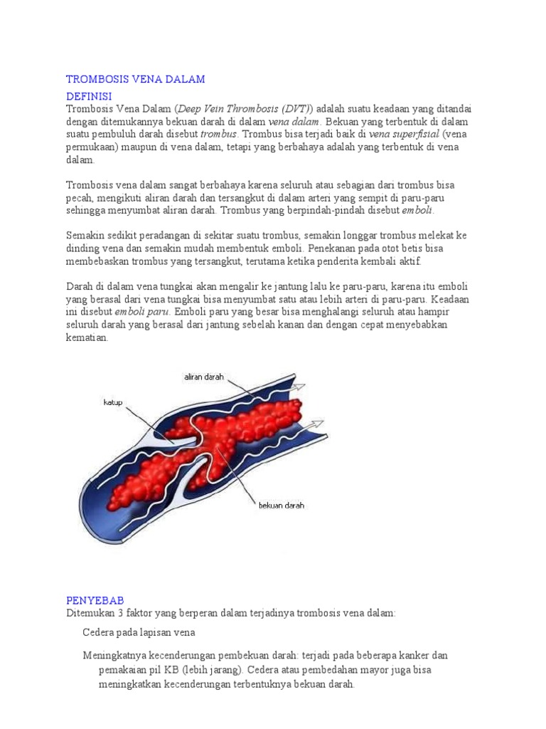 Trombosis Vena Dalam: Gejala dan Pengobatan | PDF | Sains & Matematika