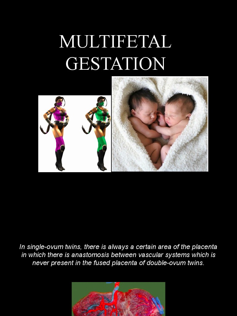 Multifetal Gestation | PDF | Twin | Pregnancy