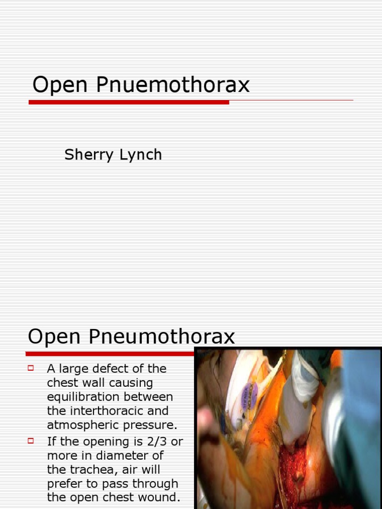 Open Pneumothorax: Causes and Treatment | PDF | Thorax | Thorax (Human ...