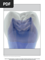 Compression Dome Concept | PDF