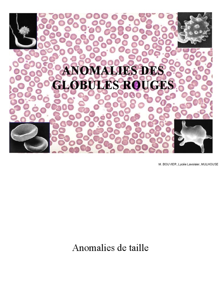 Anomalies GR | PDF | Globule rouge | Cellule (biologie)