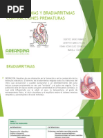 Trigeminismo Ventricular: Definición y Tratamiento | PDF