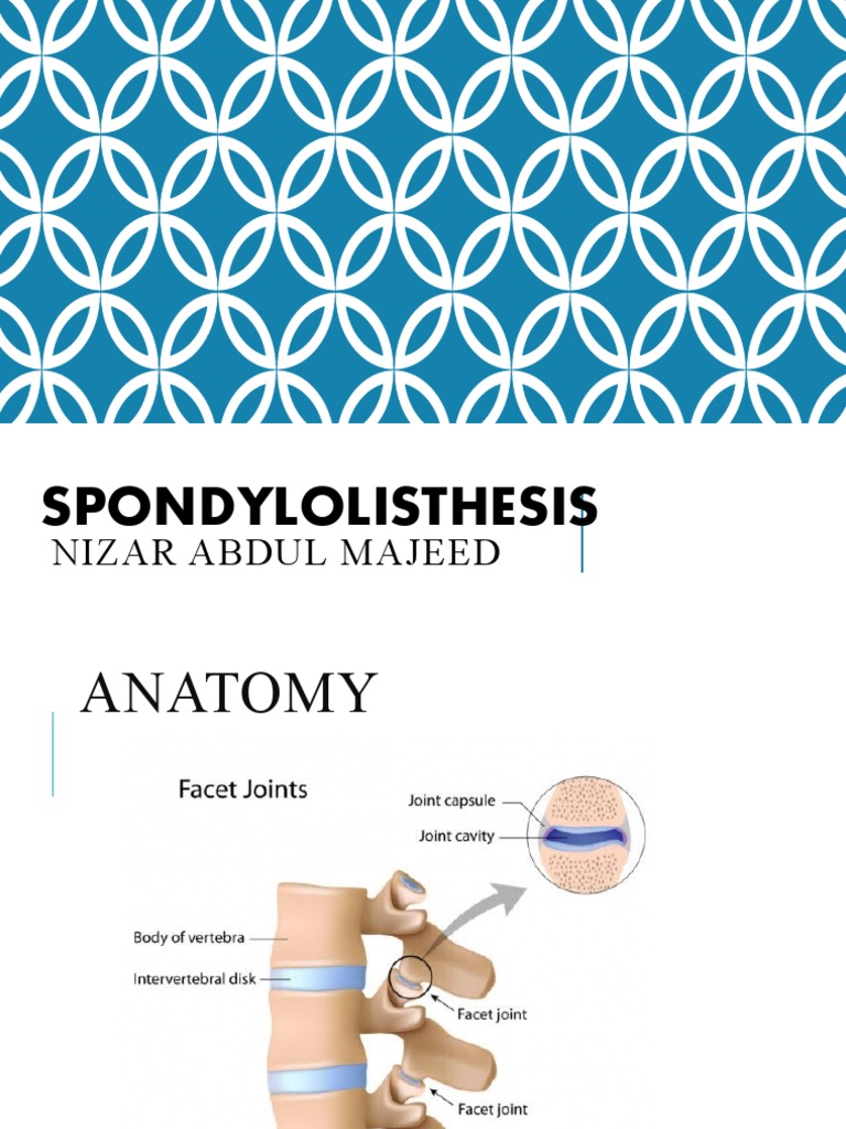 Step-Off Deformity in Spondylolisthesis | PDF | Vertebral Column | Vertebra