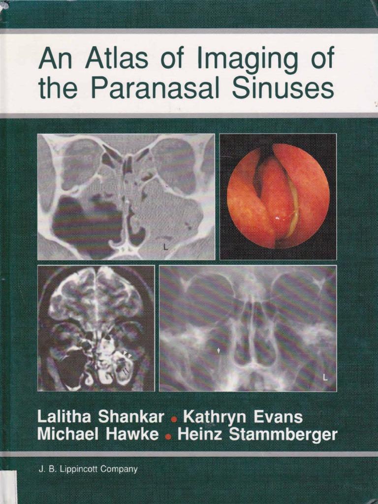 Anatomi Sinus Paranasalis PDF | PDF | Human Nose | Mucus