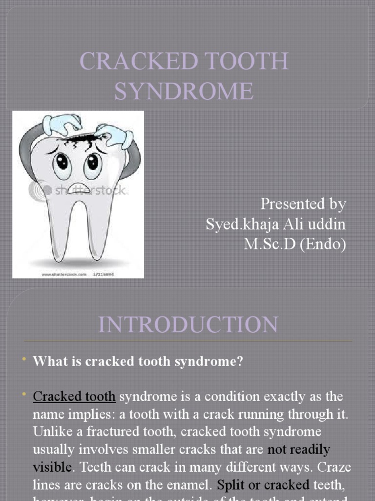 Cracked Tooth Syndrome | PDF | Symptoms And Signs: General | Human Tooth