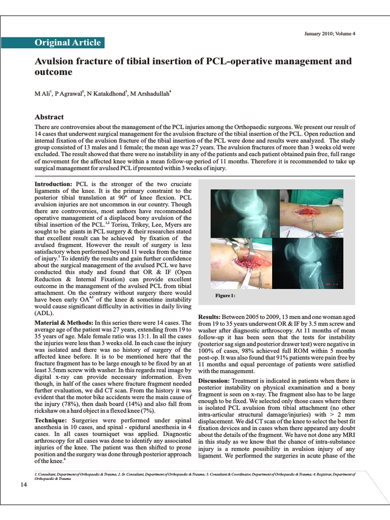 PCL Avulsion Fracture 2 | PDF | Knee | Clinical Medicine