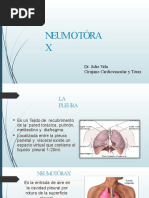Compresion Radicular. | PDF | La columna vertebral | Sistema ...