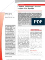 Lodwick Classification for Bone Tumor Growth | PDF | Medical Imaging ...