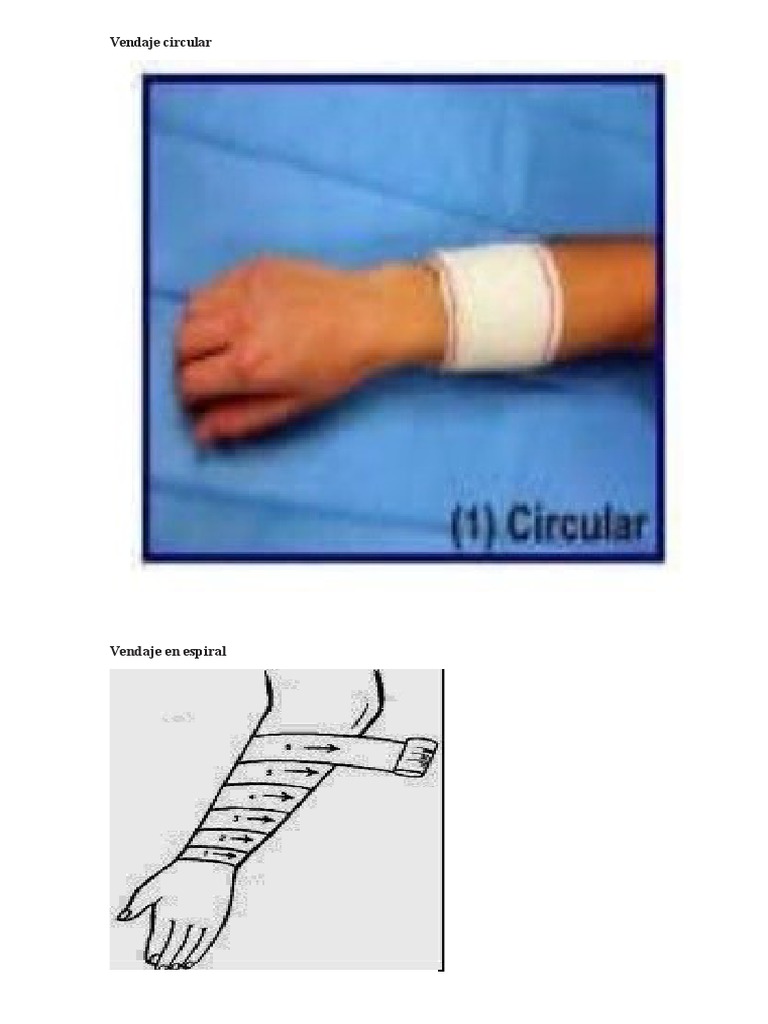 Vendaje Circular | PDF