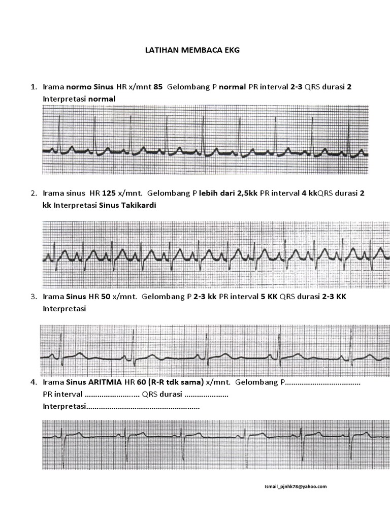Latihan Membaca Ekg | PDF