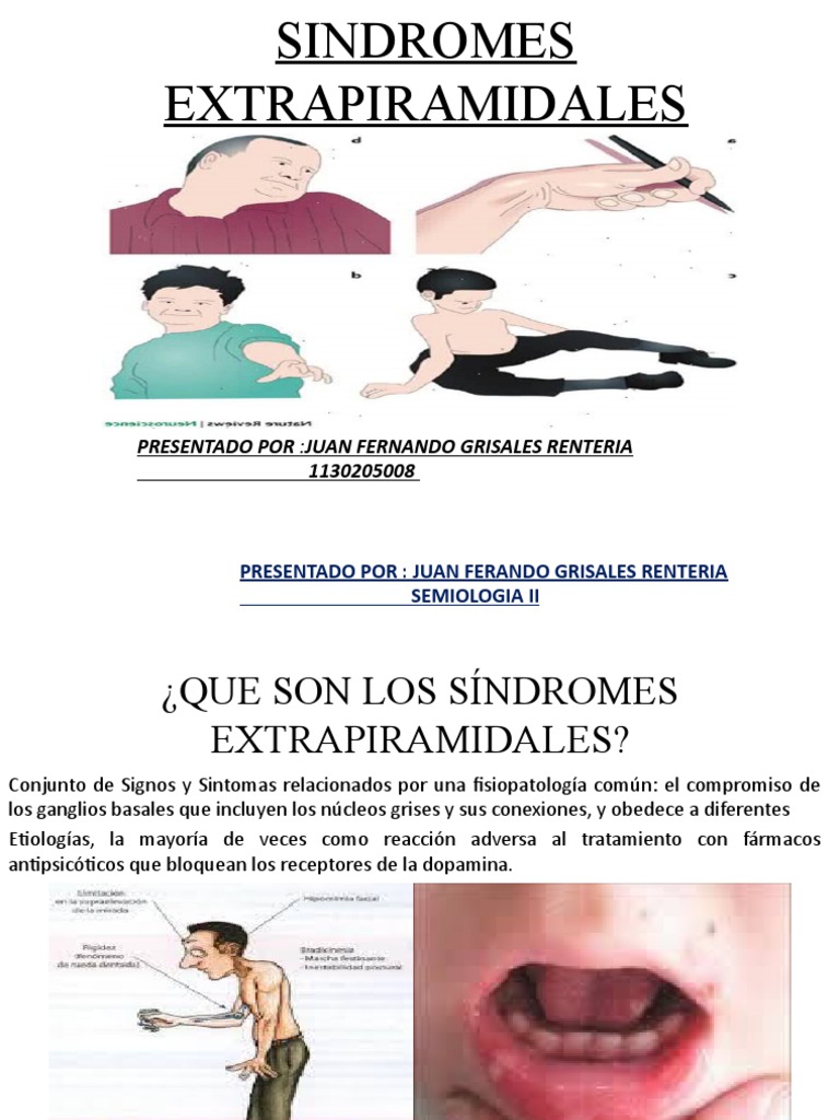 Síndromes Extrapiramidales y Tratamientos | PDF | Enfermedad de ...