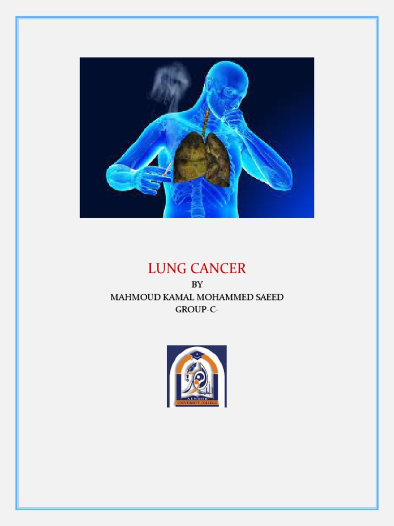 Lung Cancer | PDF | Lung Cancer | Non Small Cell Lung Carcinoma