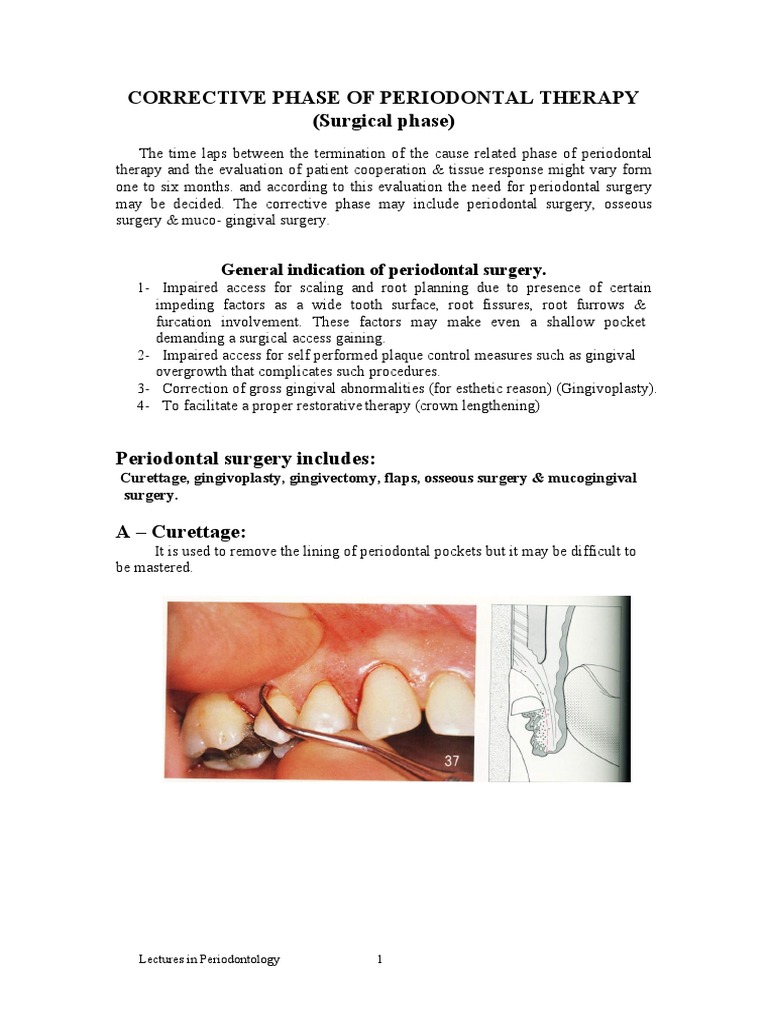 Corrective Phase of Periodontal Therapy (Surgical Phase) | PDF ...