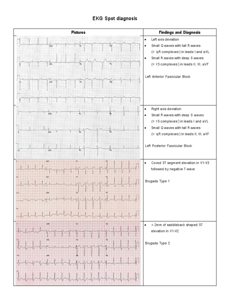 EKG Spot Diagnosis Guide | PDF | Electrocardiography | Circulatory System