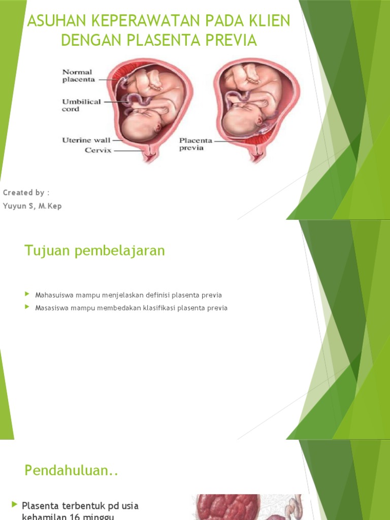 Askep Plasenta Previa 20 | PDF