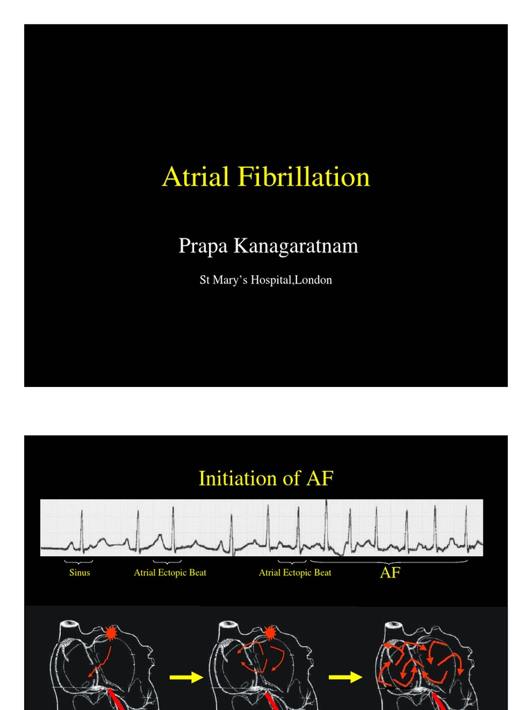 Atrial Fibrillation: Prapa Kanagaratnam | PDF | Cardiovascular System ...